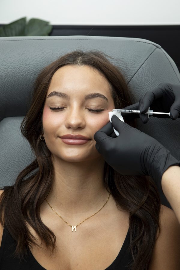 Naturally Beautiful Results with Face Fillers in Chandler, AZ